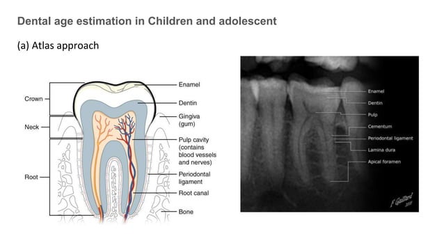 Msciii Forensic Anthropology Age Estimation Using Dentition Pptx