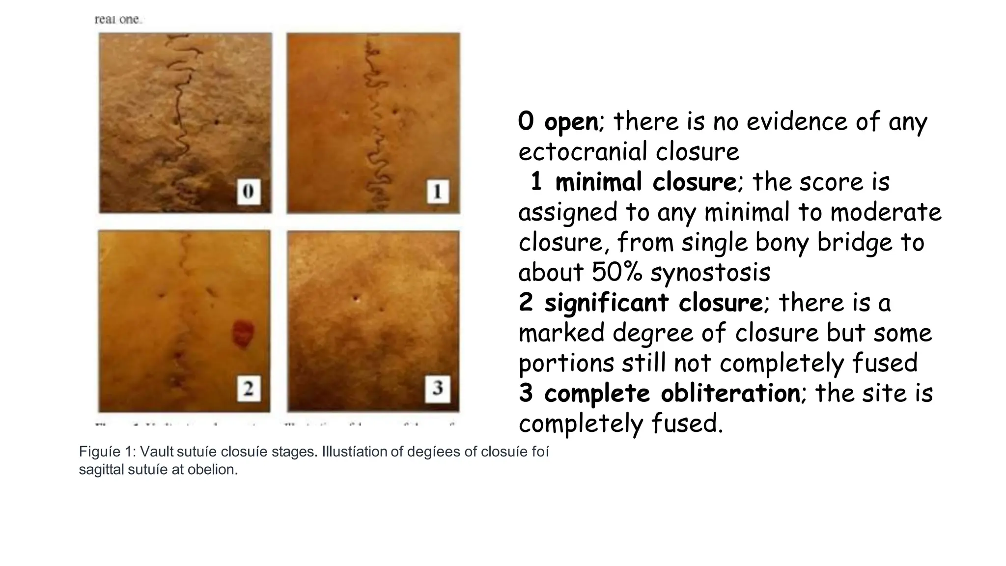 MSCIII_Forensic anthropology_Personal Identification.pptx
