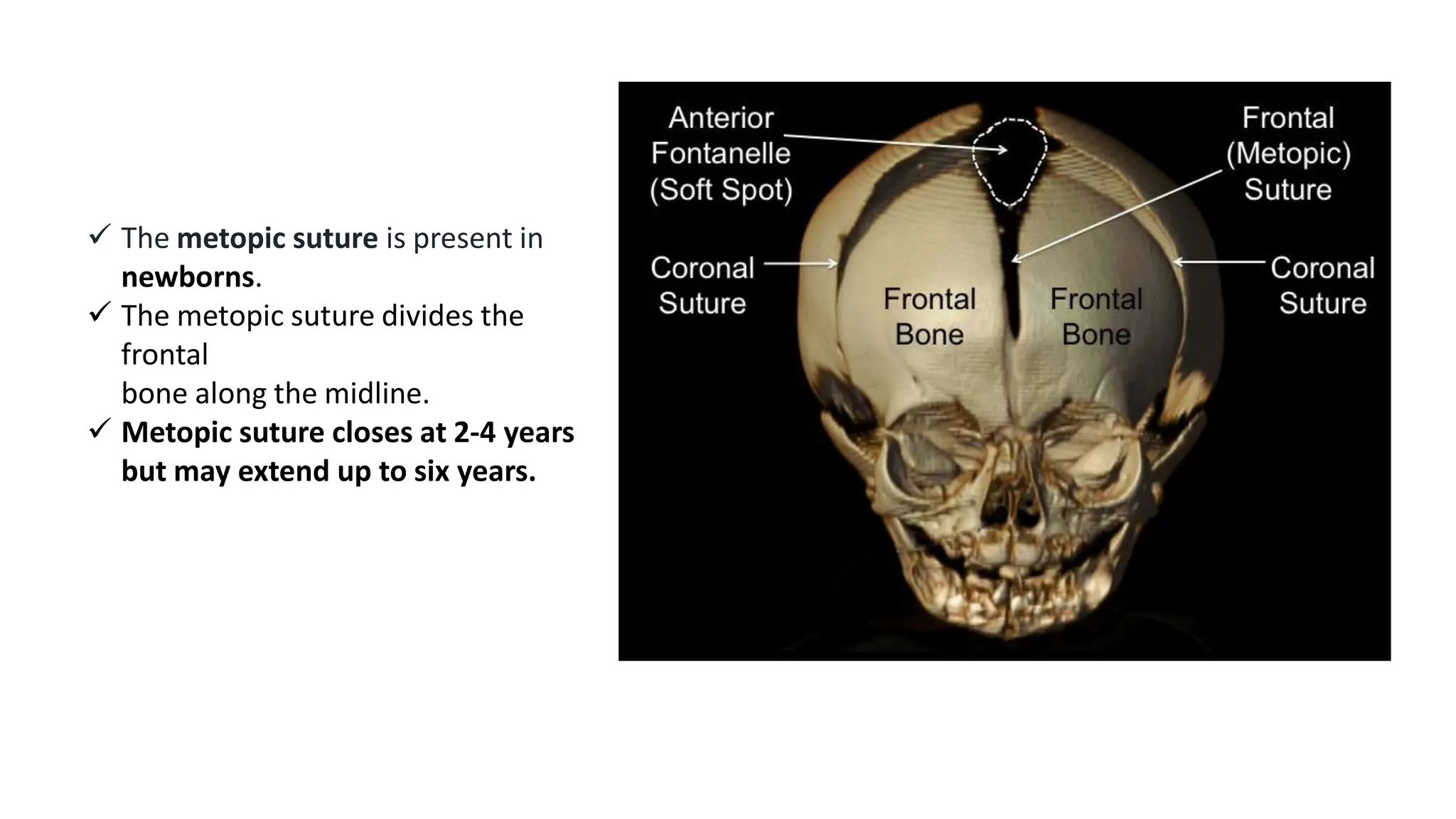 MSCIII_Forensic anthropology_Personal Identification.pptx