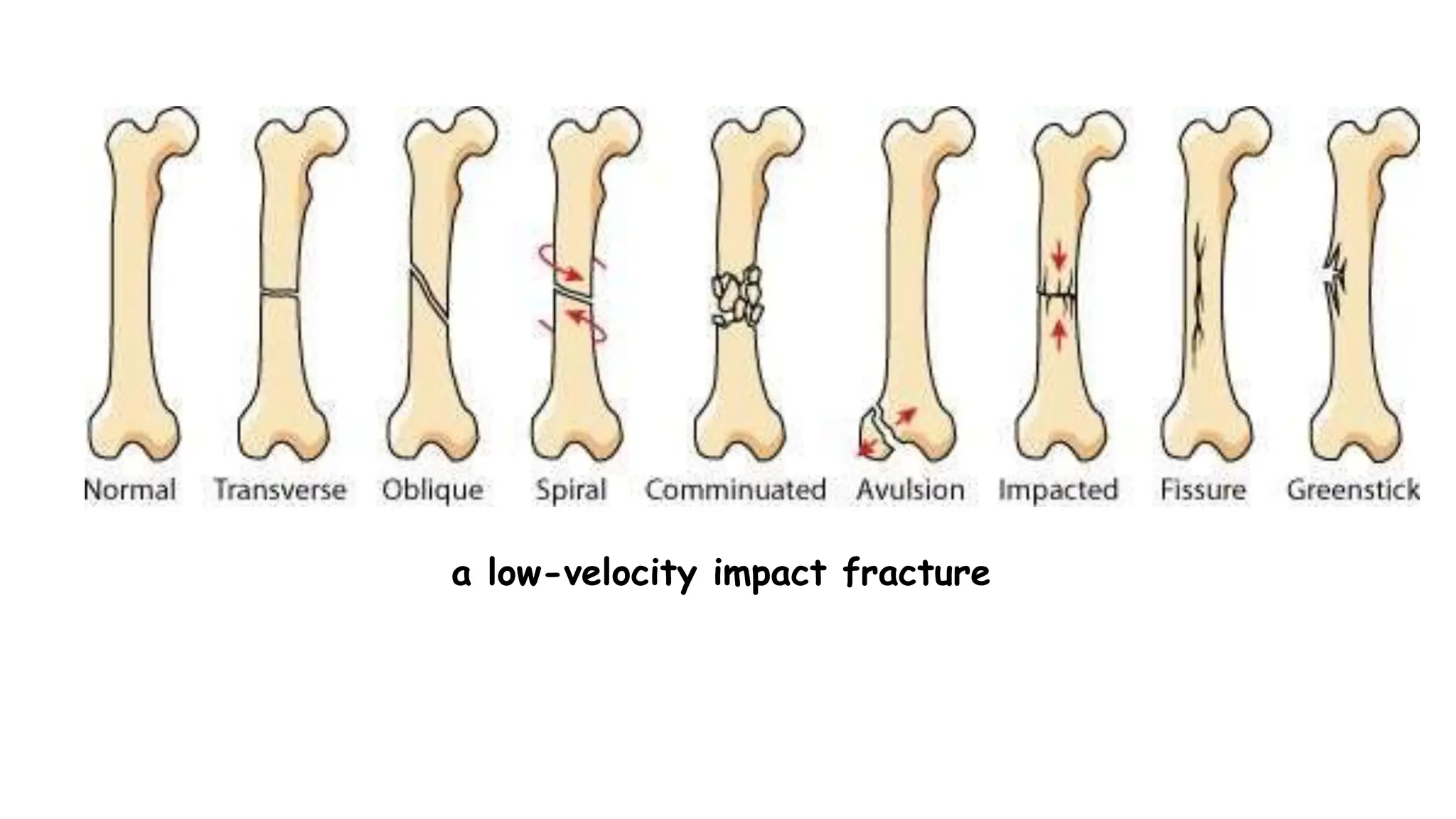 MSCIII_Forensic anthropology_Trauma analysis.pptx