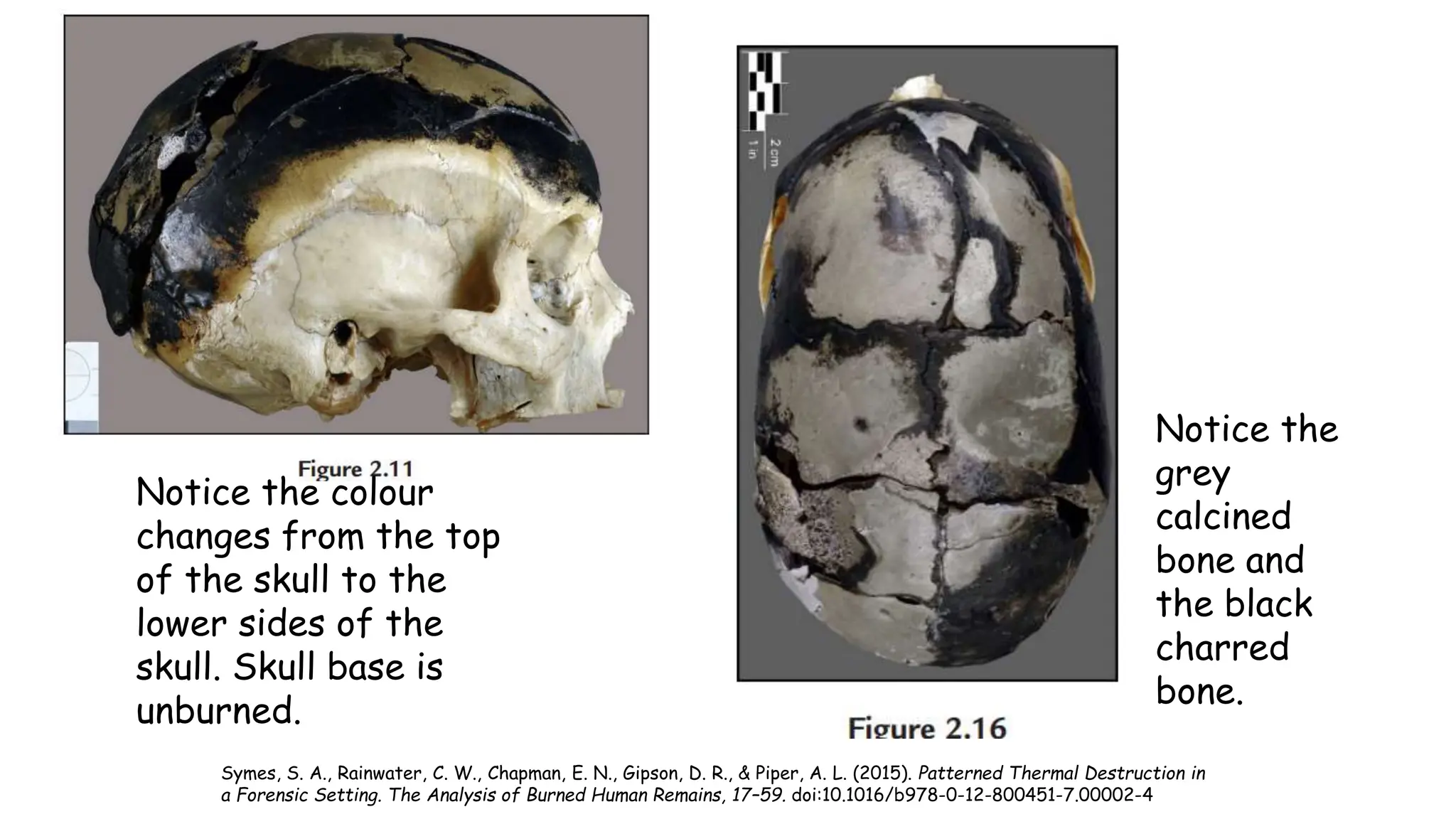 MSCIII_Forensic anthropology_Trauma analysis.pptx