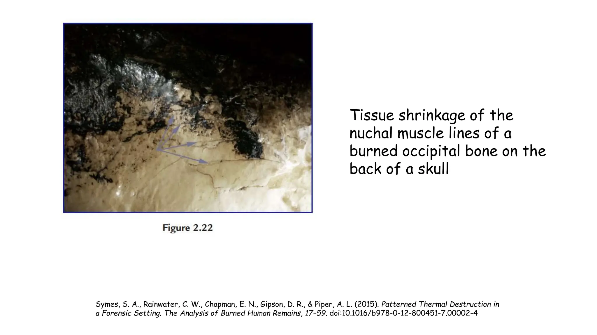 MSCIII_Forensic anthropology_Trauma analysis.pptx
