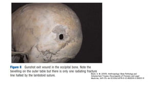 MSCIII_Forensic anthropology_Trauma analysis.pptx