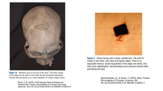 MSCIII_Forensic anthropology_Trauma analysis.pptx