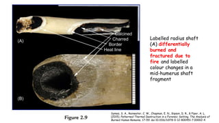 MSCIII_Forensic anthropology_Trauma analysis.pptx