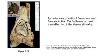 MSCIII_Forensic anthropology_Trauma analysis.pptx