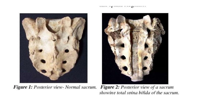 MSCIII_Forensic anthropology_Trauma analysis.pptx MSCIII_Forensic anthropology_Trauma analysis.pptx