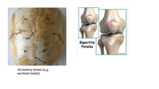 MSCIII_Forensic anthropology_Trauma analysis.pptx