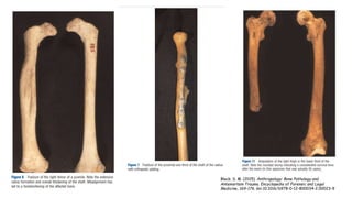 MSCIII_Forensic anthropology_Trauma analysis.pptx