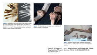 MSCIII_Forensic anthropology_Trauma analysis.pptx