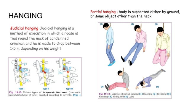 MSC IV_Forensic medicine - autopsy.pdf