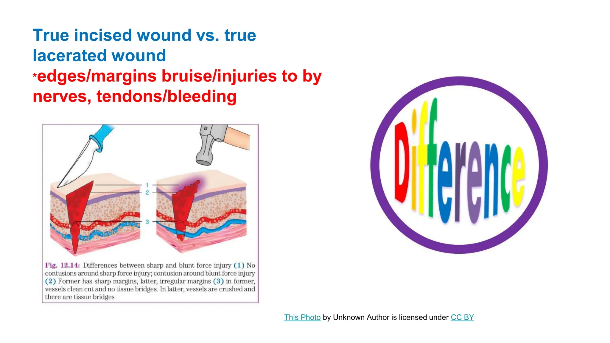 MSC IV_Forensic medicine - Mechanical injuries.pdf