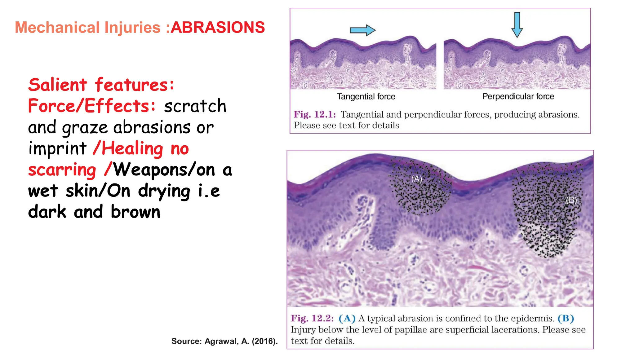 MSC IV_Forensic medicine - Mechanical injuries.pdf