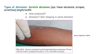 MSC IV_Forensic medicine - Mechanical injuries.pdf