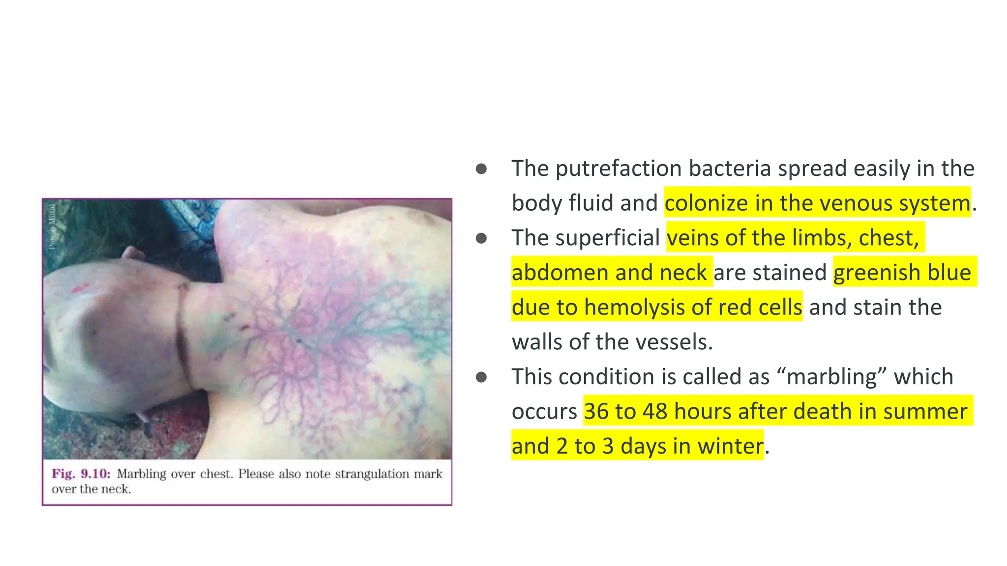MSC IV_Forensic medicine - Thanatology.pdf