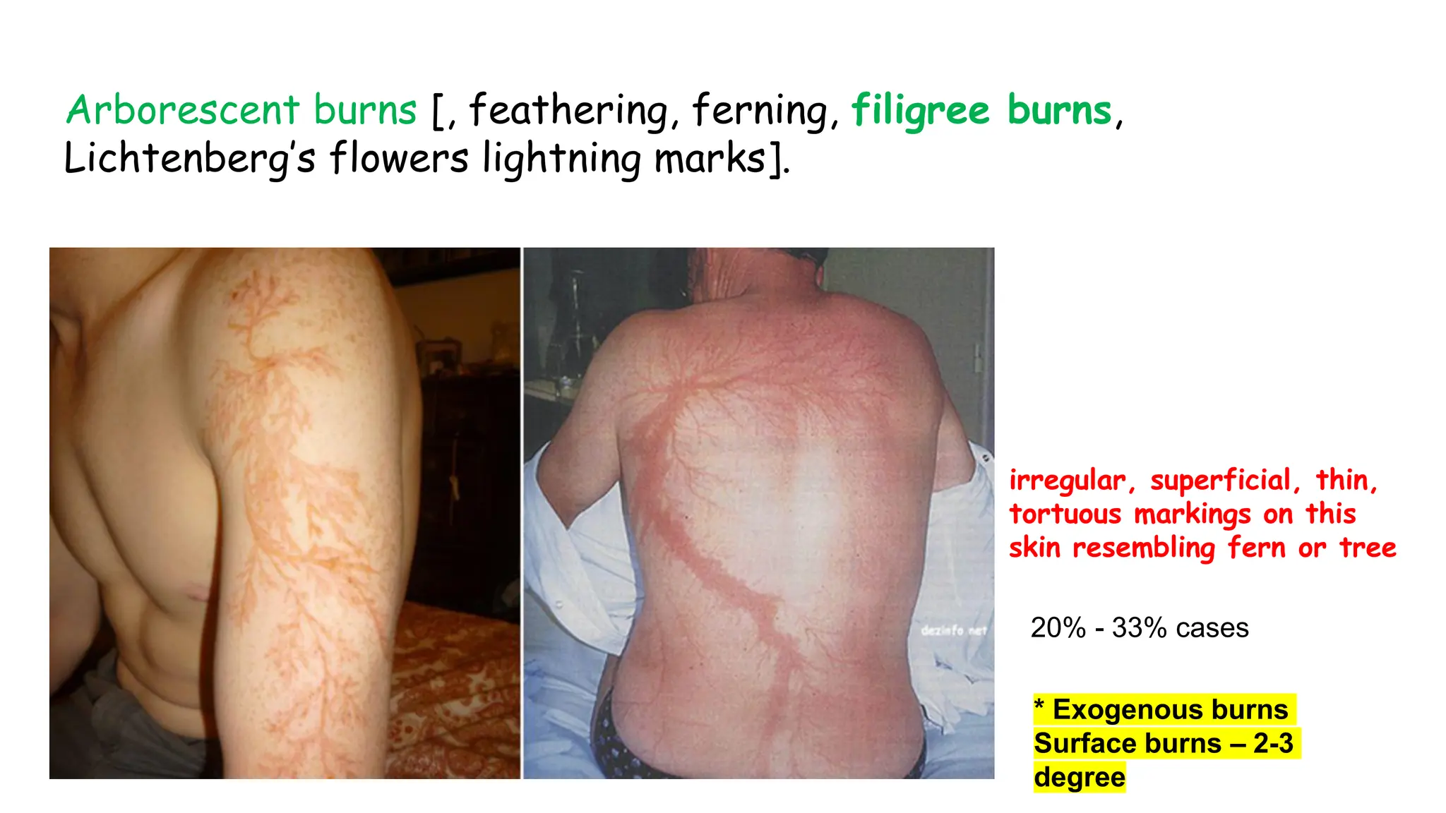 MSC IV_Forensic medicine - Thermal and firearm injuries.pdf