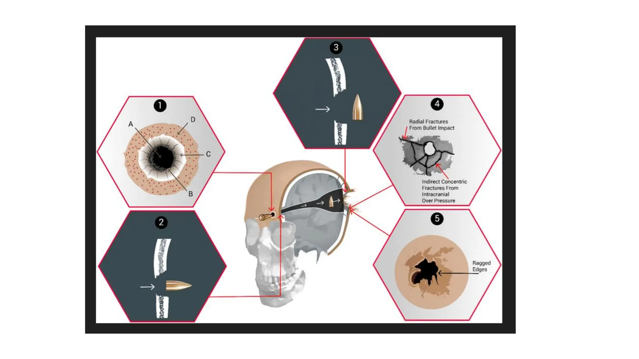 MSC IV_Forensic medicine - Thermal and firearm injuries.pdf