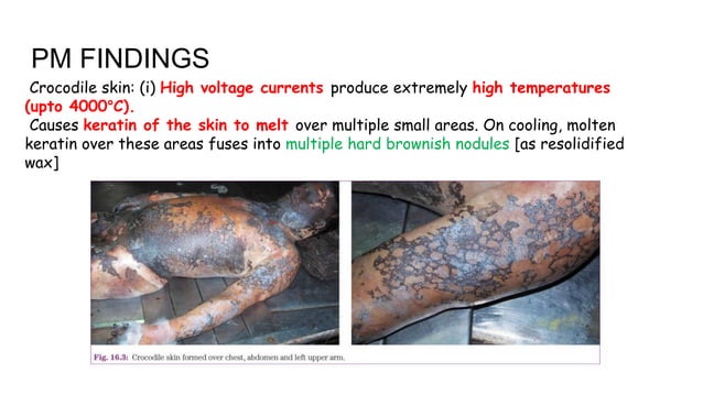 MSC IV_Forensic medicine - Thermal and firearm injuries.pdf