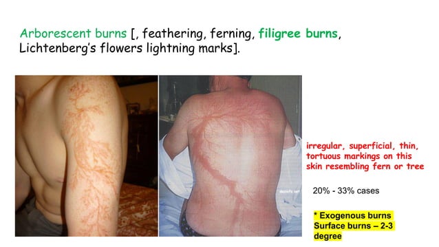 MSC IV_Forensic medicine - Thermal and firearm injuries.pdf