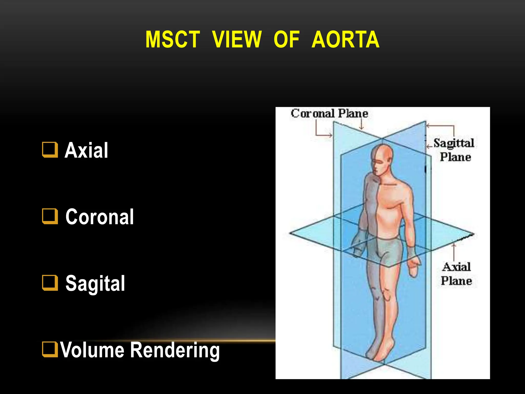CT Imaging examination about aorta and it's disease | PPT