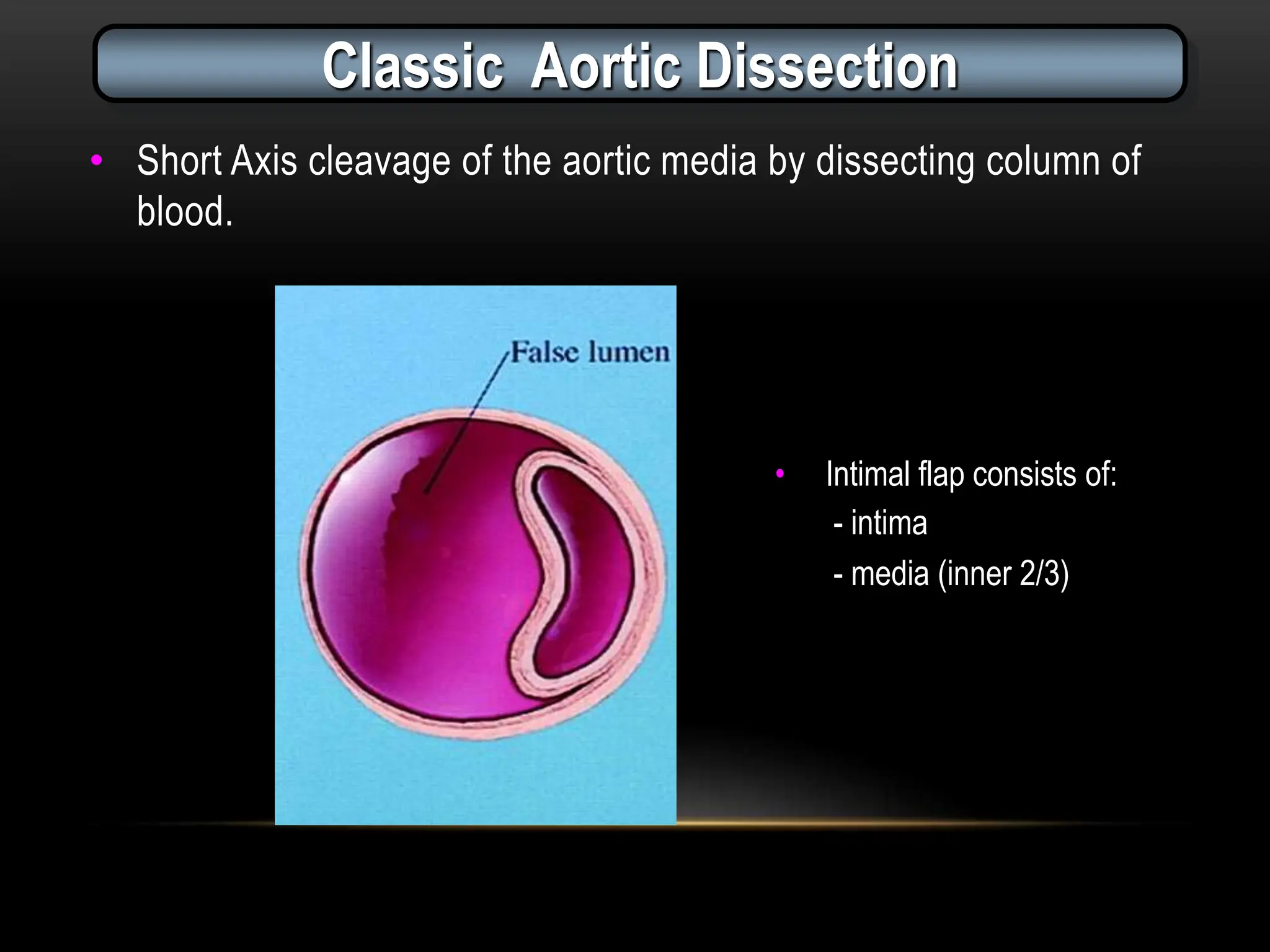 CT Imaging examination about aorta and it's disease | PPT