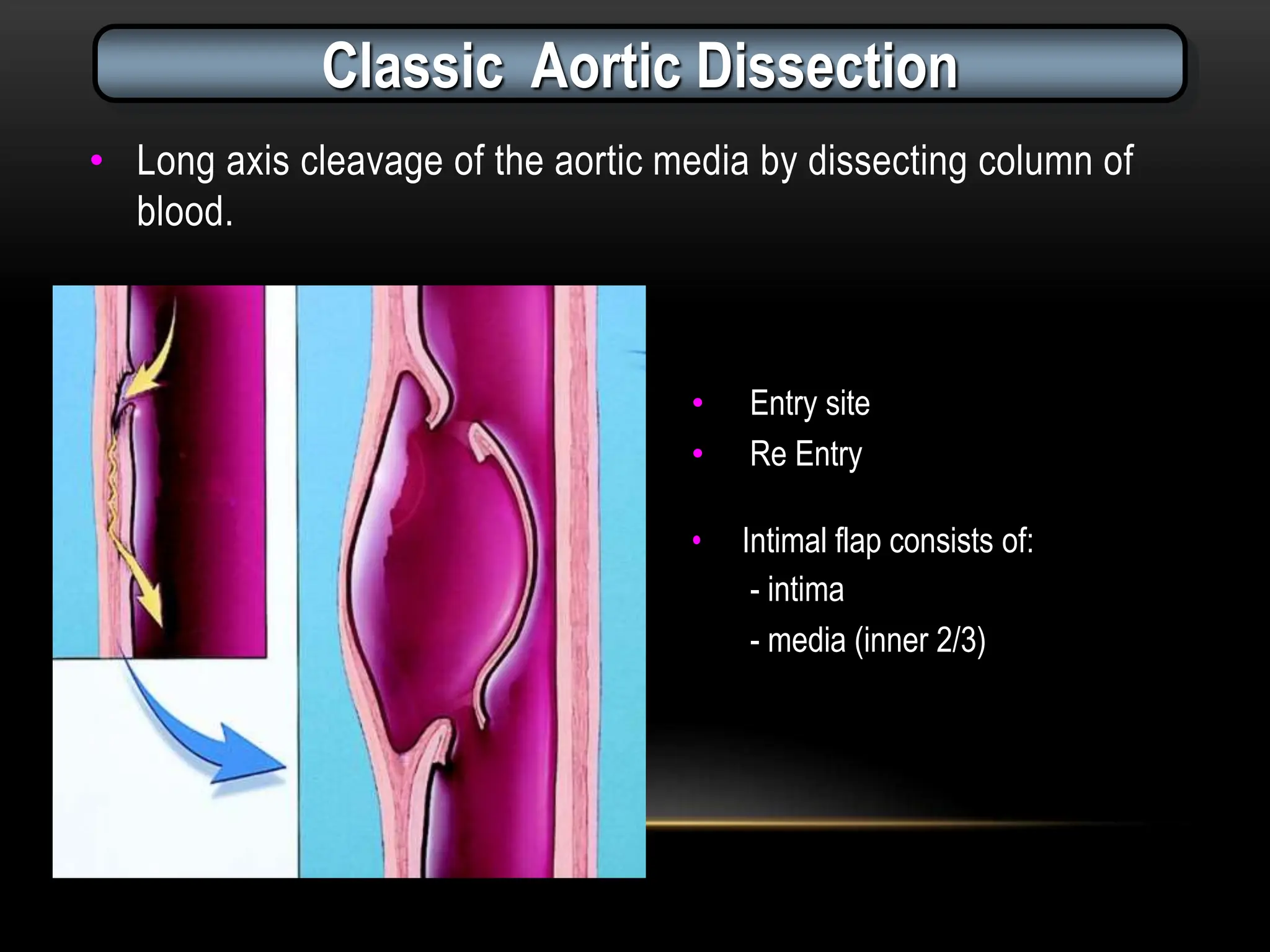 CT Imaging examination about aorta and it's disease | PPT | Death ...