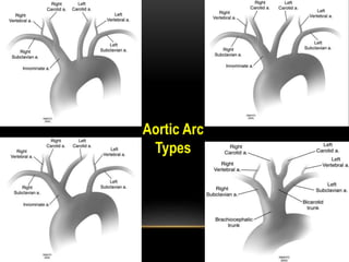 CT Imaging examination about aorta and it's disease | PPT