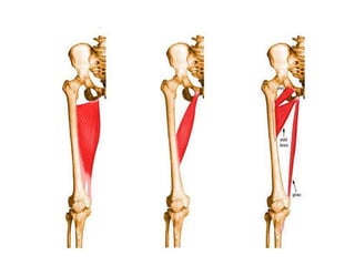 Músculos de la región femoral | PPT