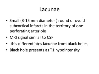 MRI differential diagnosis of Multiple sclerosis | PPTX