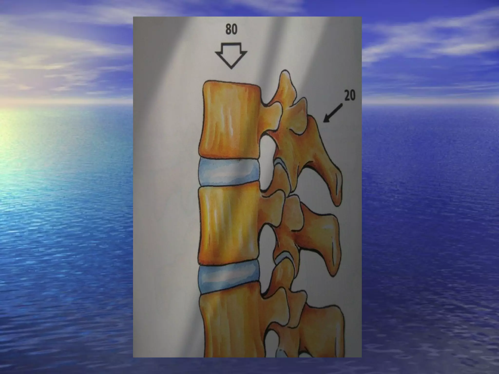 thoracolumbar fractures -anterior column reconstruction | PPT
