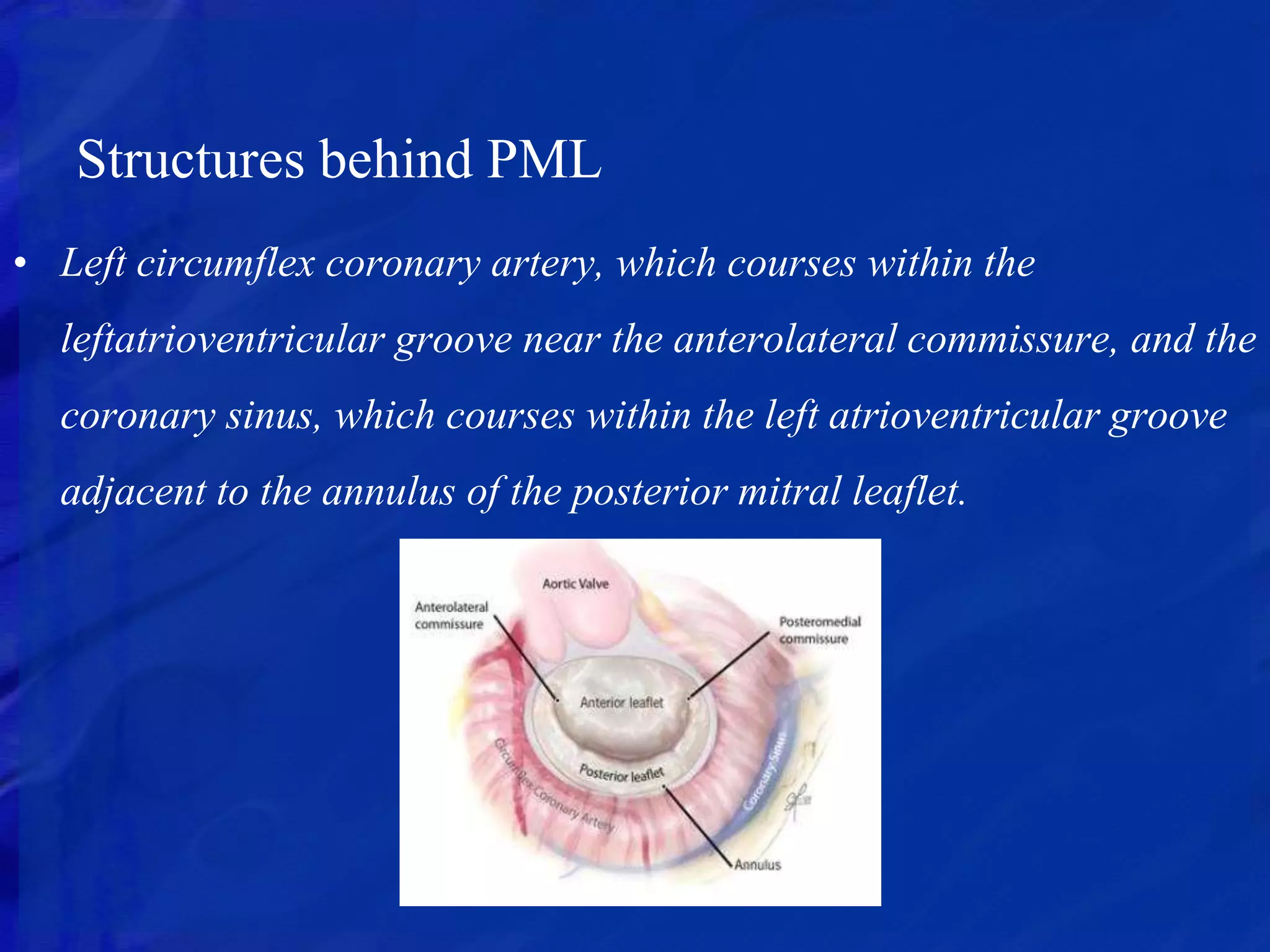 ECHOCARDIOGRAPHIC EVALUATION OF MITRAL VALVE DISEASE | PPTX