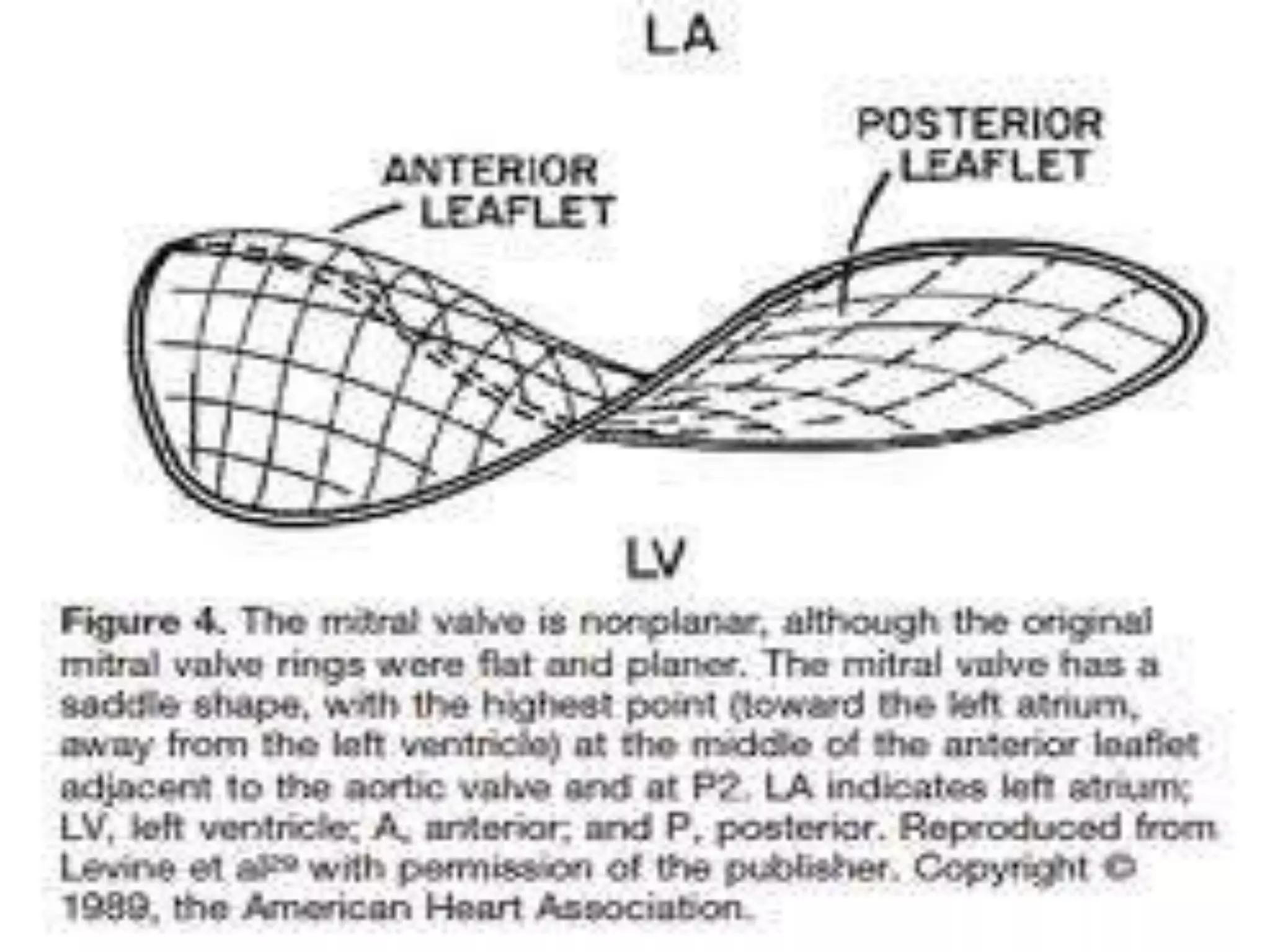 ECHOCARDIOGRAPHIC EVALUATION OF MITRAL VALVE DISEASE | PPTX