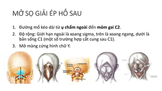 Mở sọ giải ép | PPTX