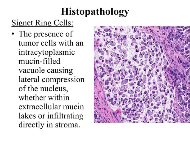 Microsatellite instability | PPT