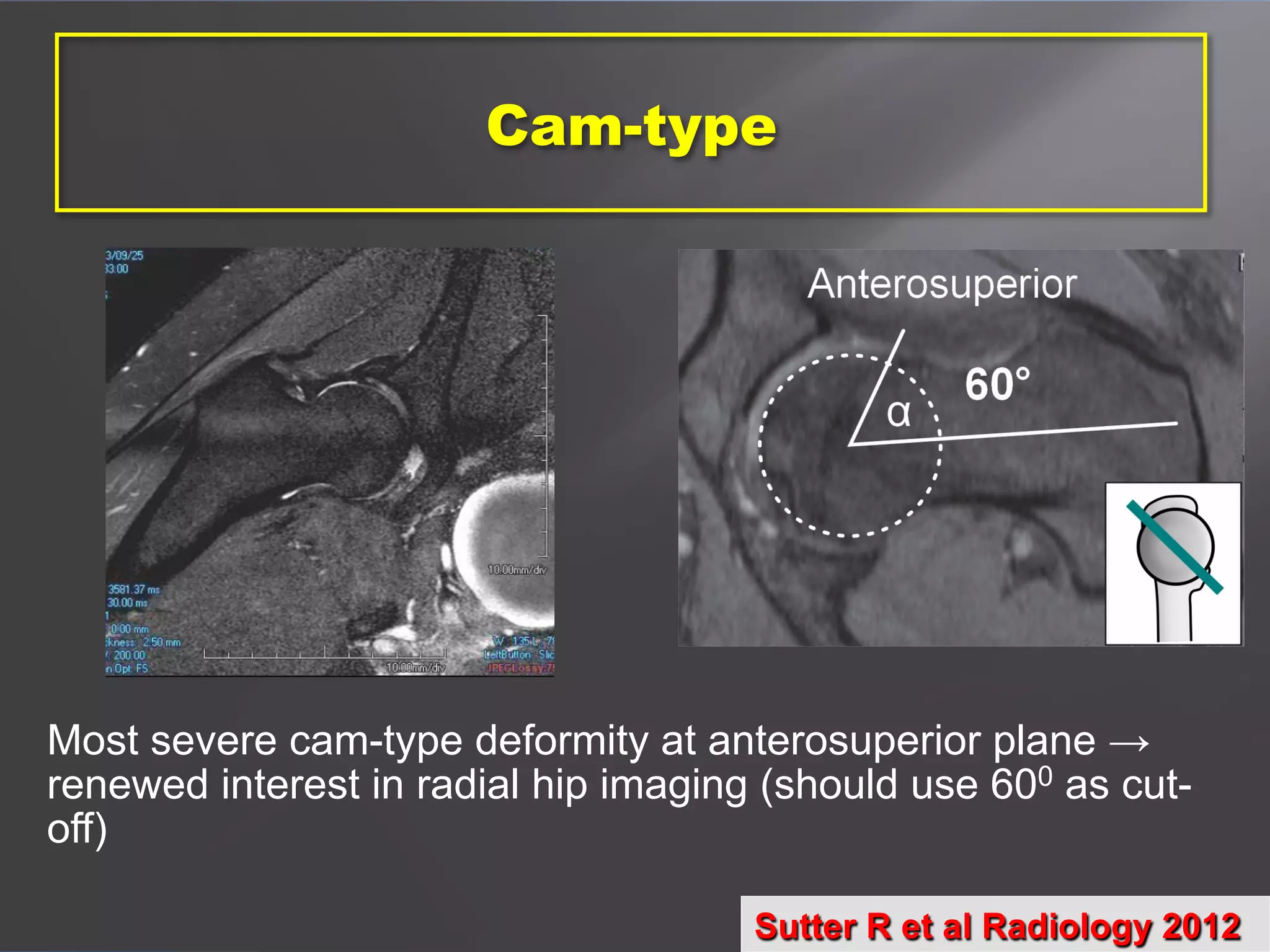 Msk imaging adult hip pain j griffith | PDF