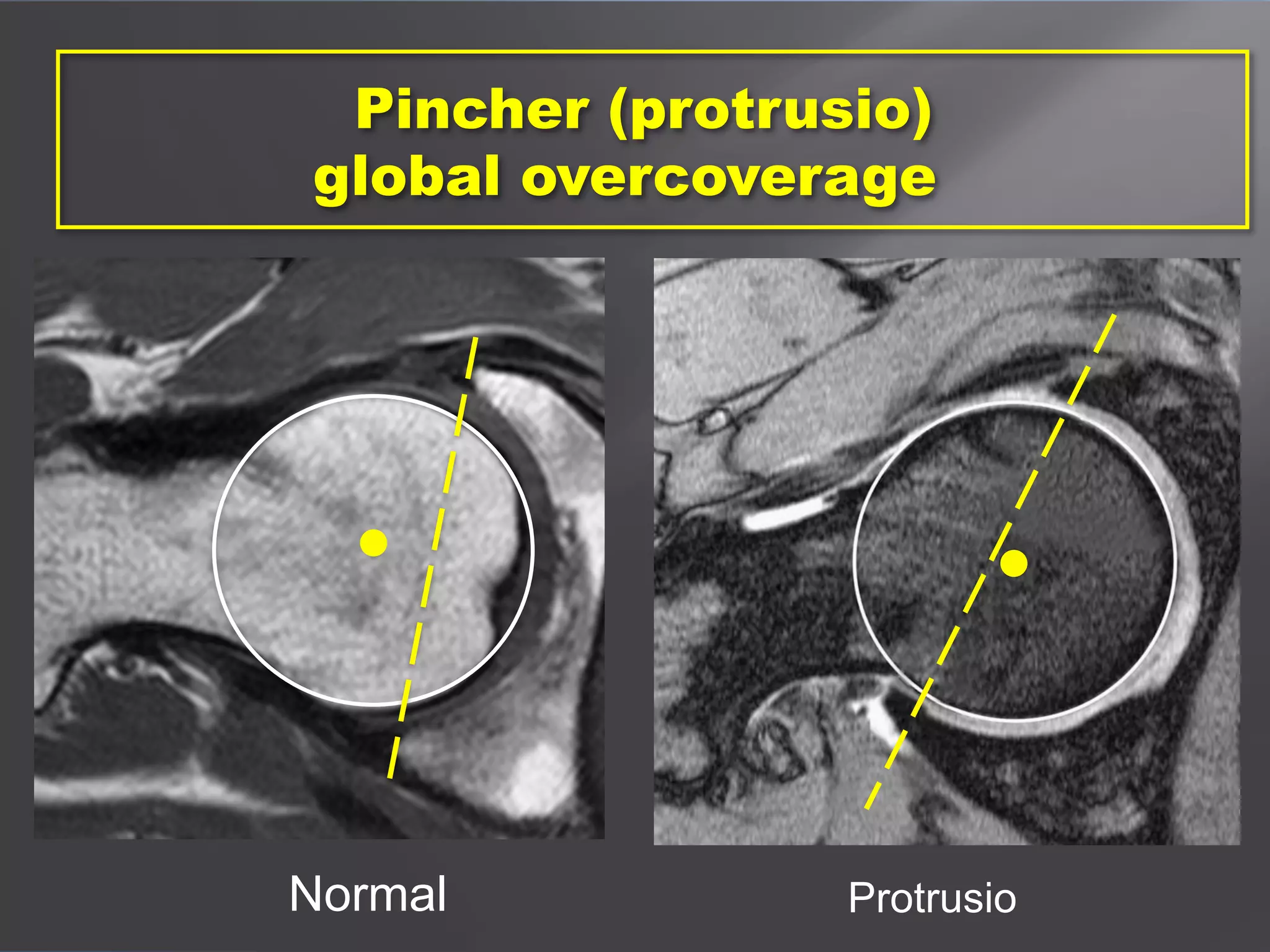 Msk imaging adult hip pain j griffith | PDF