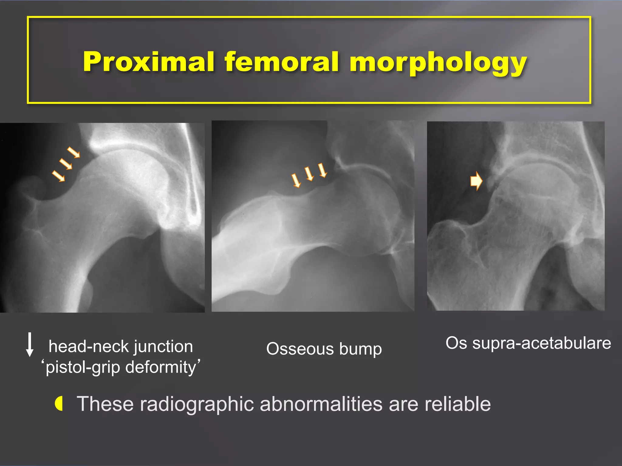 Msk imaging adult hip pain j griffith | PDF