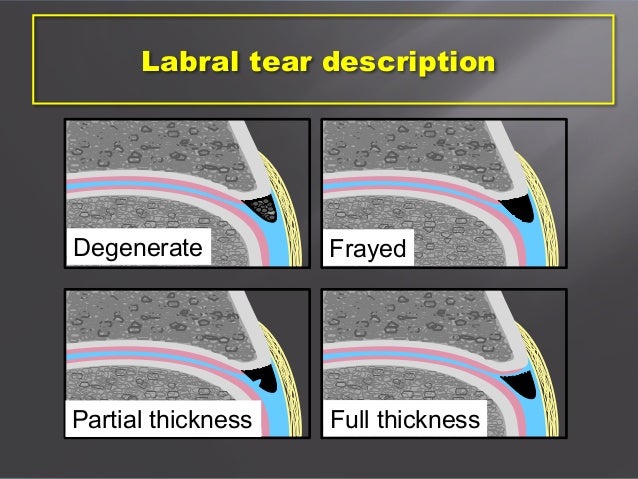 Msk imaging adult hip pain j griffith