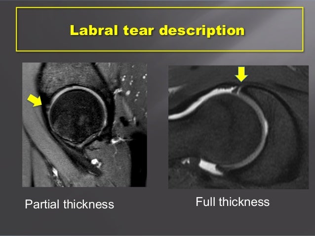 Msk imaging adult hip pain j griffith