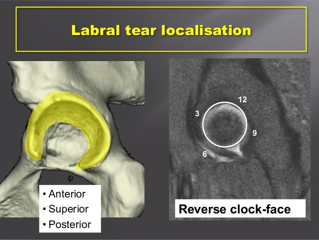 Msk imaging adult hip pain j griffith