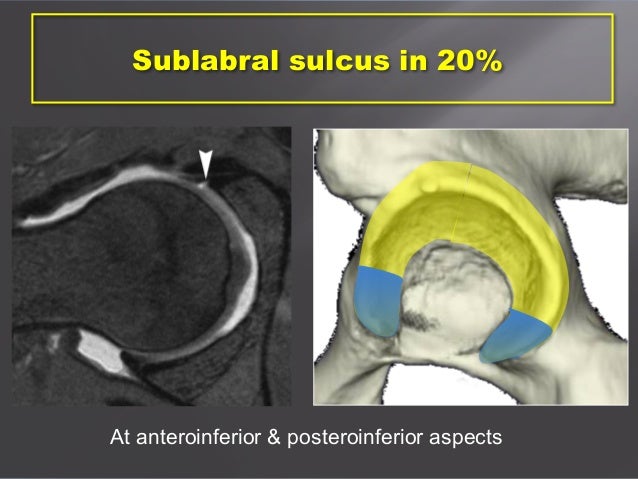 Msk imaging adult hip pain j griffith