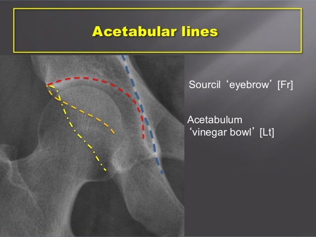 Msk imaging adult hip pain j griffith