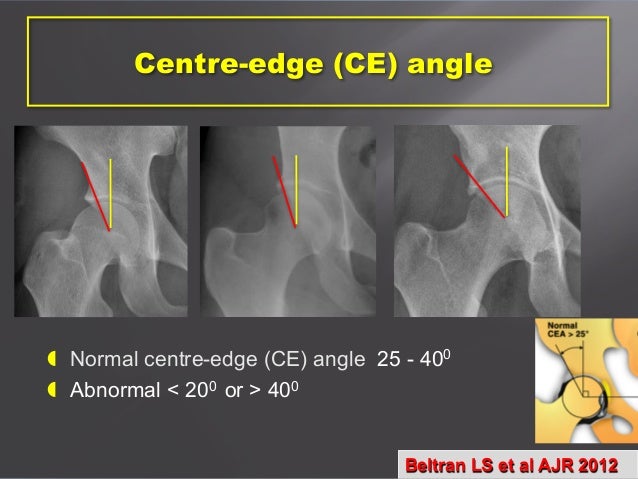 Msk imaging adult hip pain j griffith