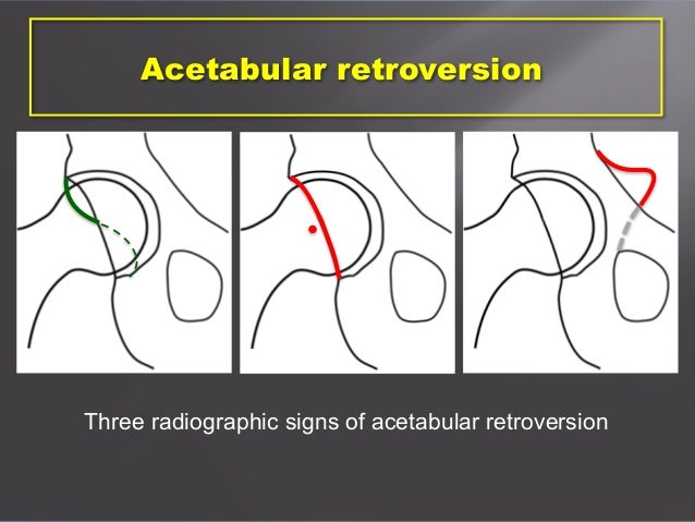Msk imaging adult hip pain j griffith