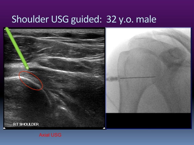 Msk imaging msk intv rad gantonio | PPT