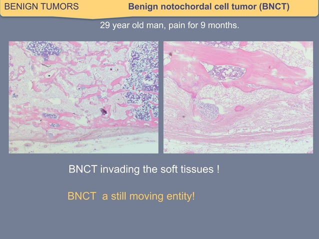 Msk imaging pelvic bone t d vanel | PDF | Cancer | Diseases and Conditions
