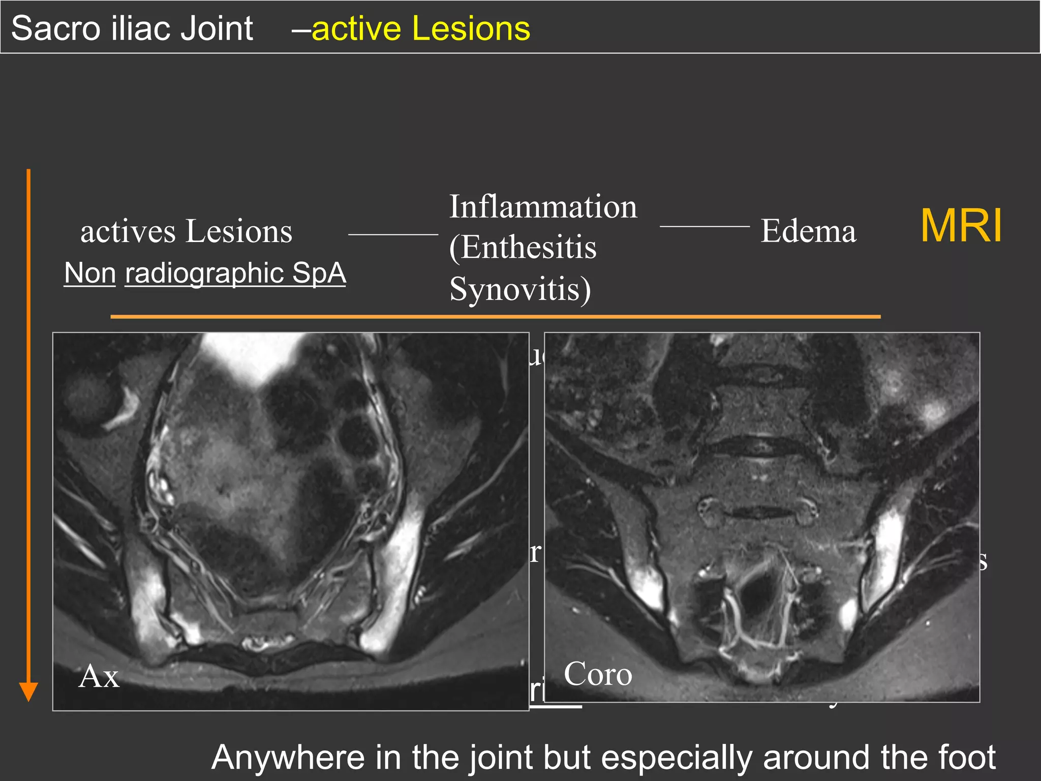 Msk imaging sacro iliac c cyteval | PDF