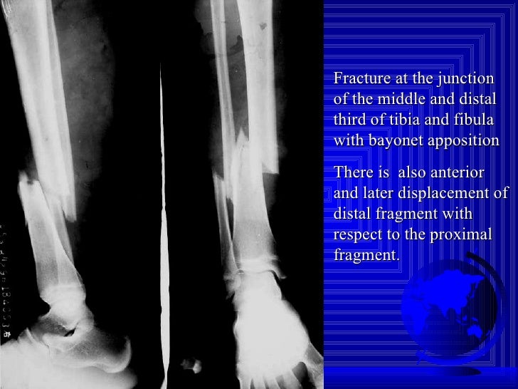 Msk Lecture2 1st Hospital