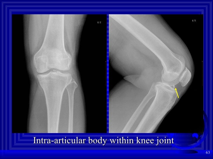 Msk Lecture3 1st Hospital