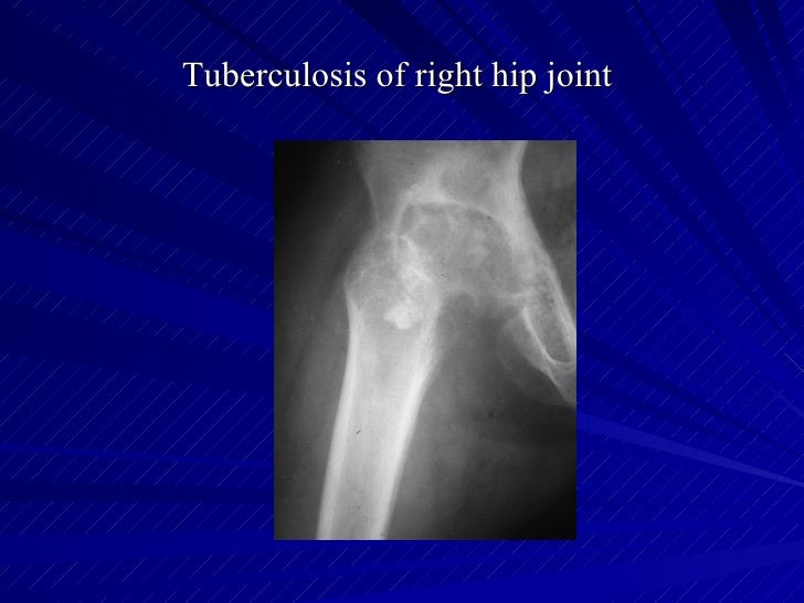 Msk Pratice3 1st Hospital